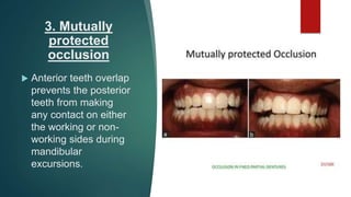 Dentistry pptx on topic of normal occlusion | PPT