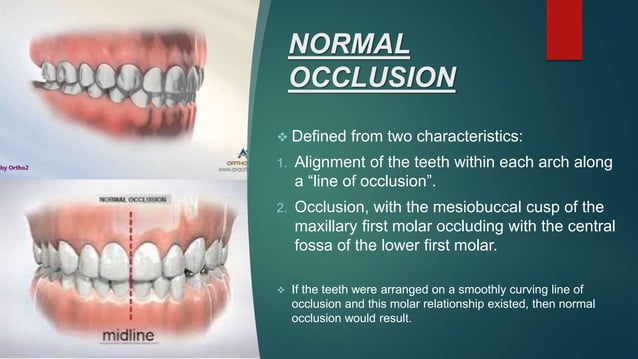Dentistry pptx on topic of normal occlusion | PPT