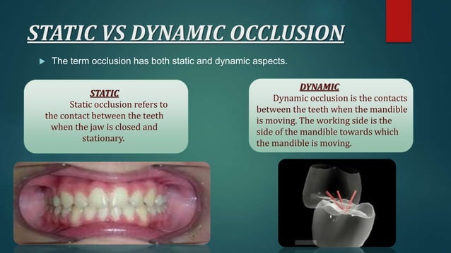 Dentistry pptx on topic of normal occlusion | PPT