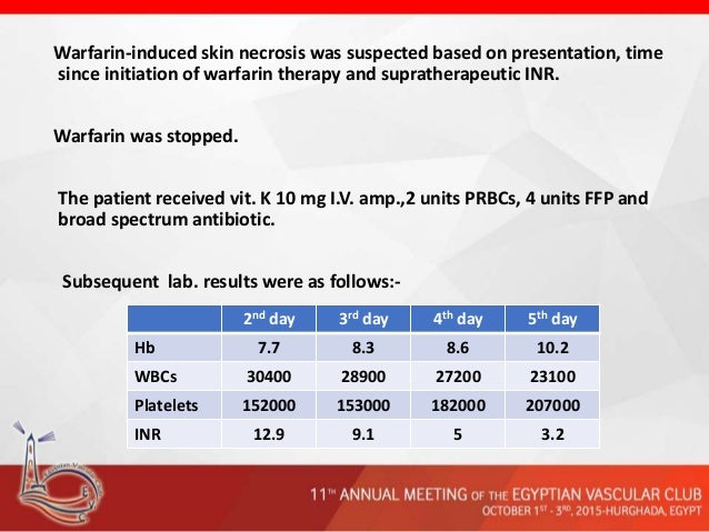 Warfarin induced skin necrosis