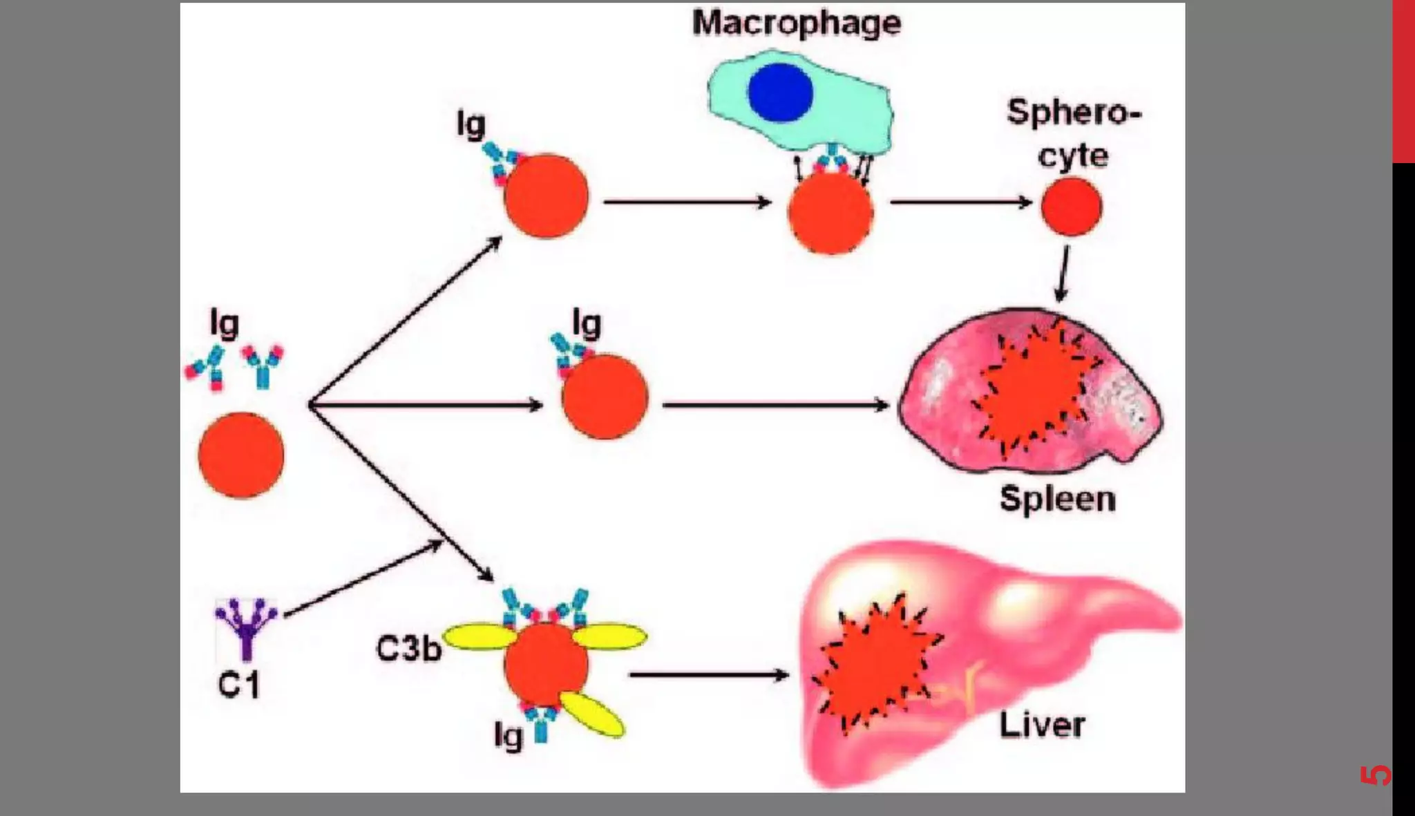 Warm and cold autoimmune hemolytic anemia | PDF