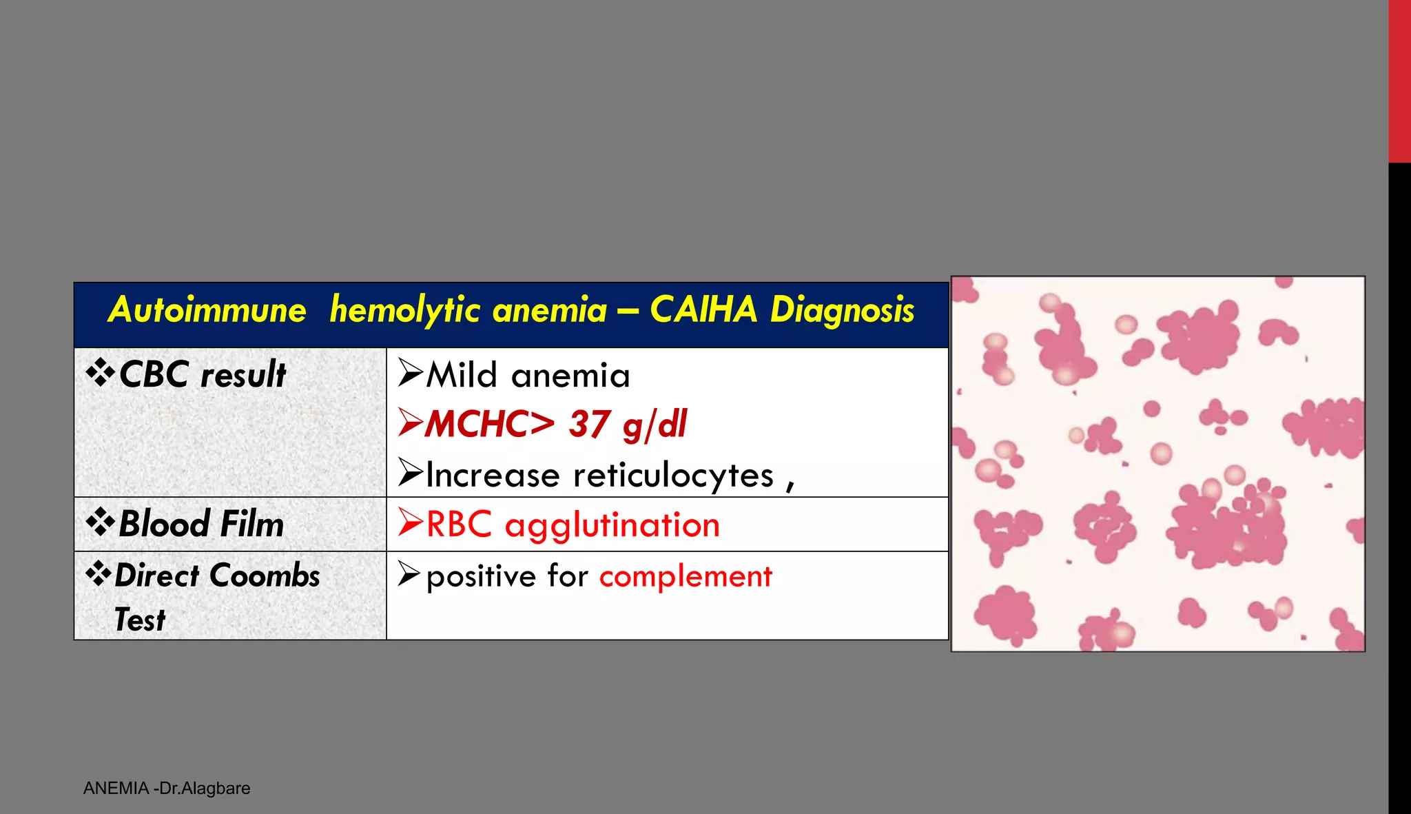 Warm and cold autoimmune hemolytic anemia | PDF
