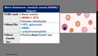 Warm and cold autoimmune hemolytic anemia | PDF