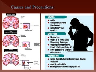 Warning Signs of Alzheimer’s disease | PPTX