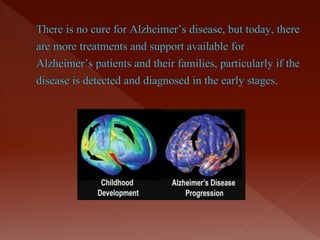 Warning Signs of Alzheimer’s disease | PPTX