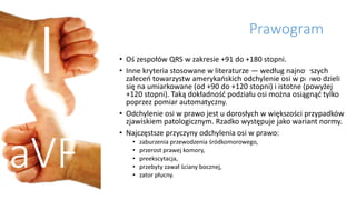 Warsztaty ekg cz. 2 podstawy ekg | PPTX