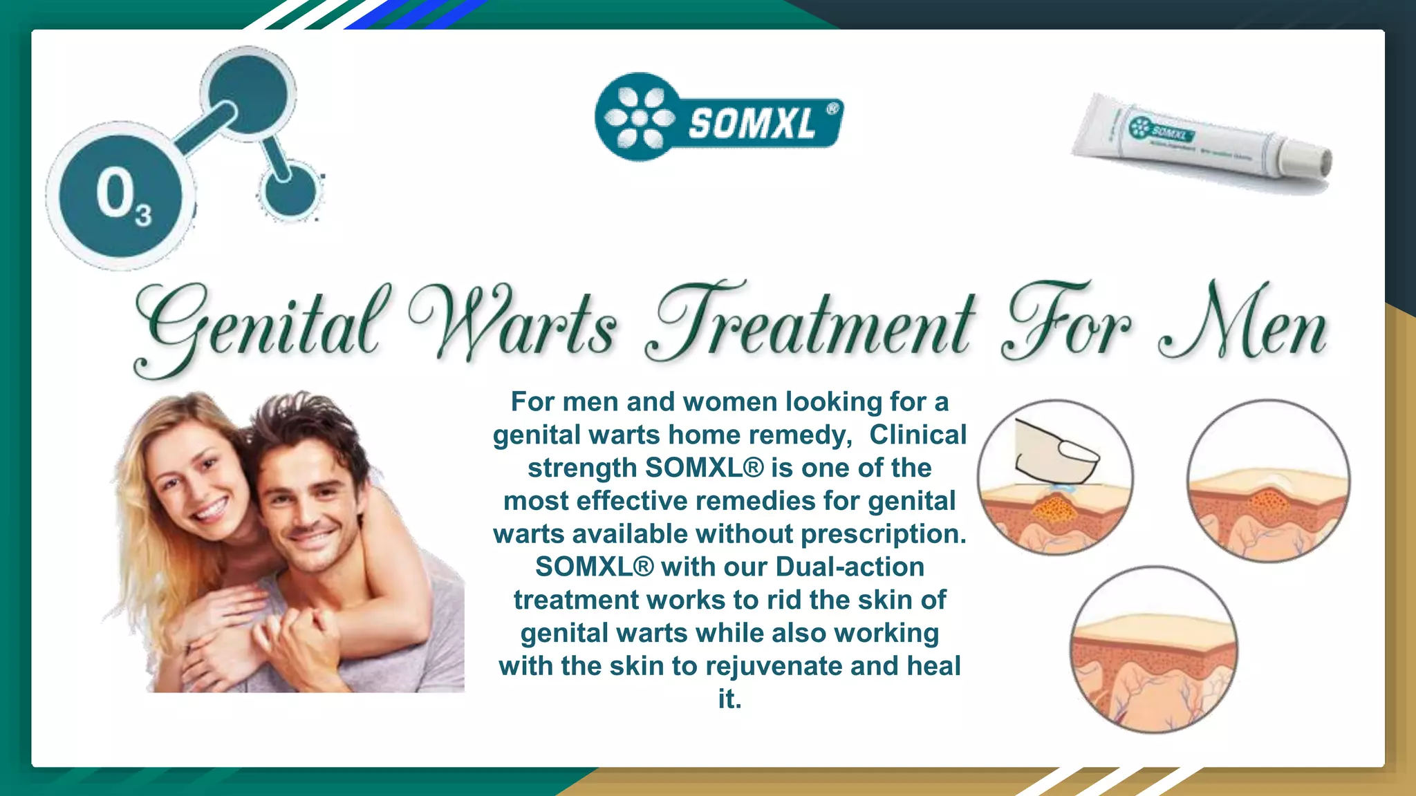 Wart removal products wart cream | PPTX