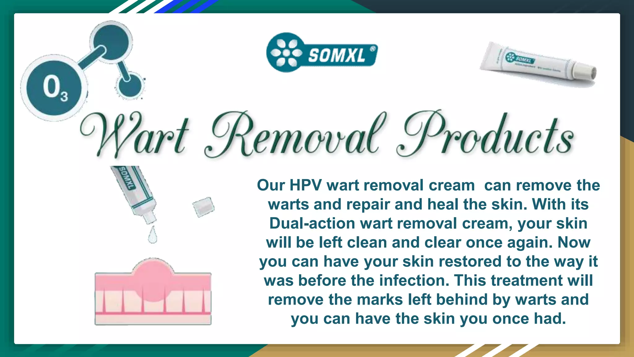 Wart removal products wart cream | PPTX