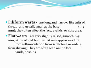 Warts | PPTX
