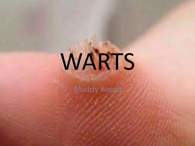 Warts | PPTX | Skin and Dermatology | Diseases and Conditions