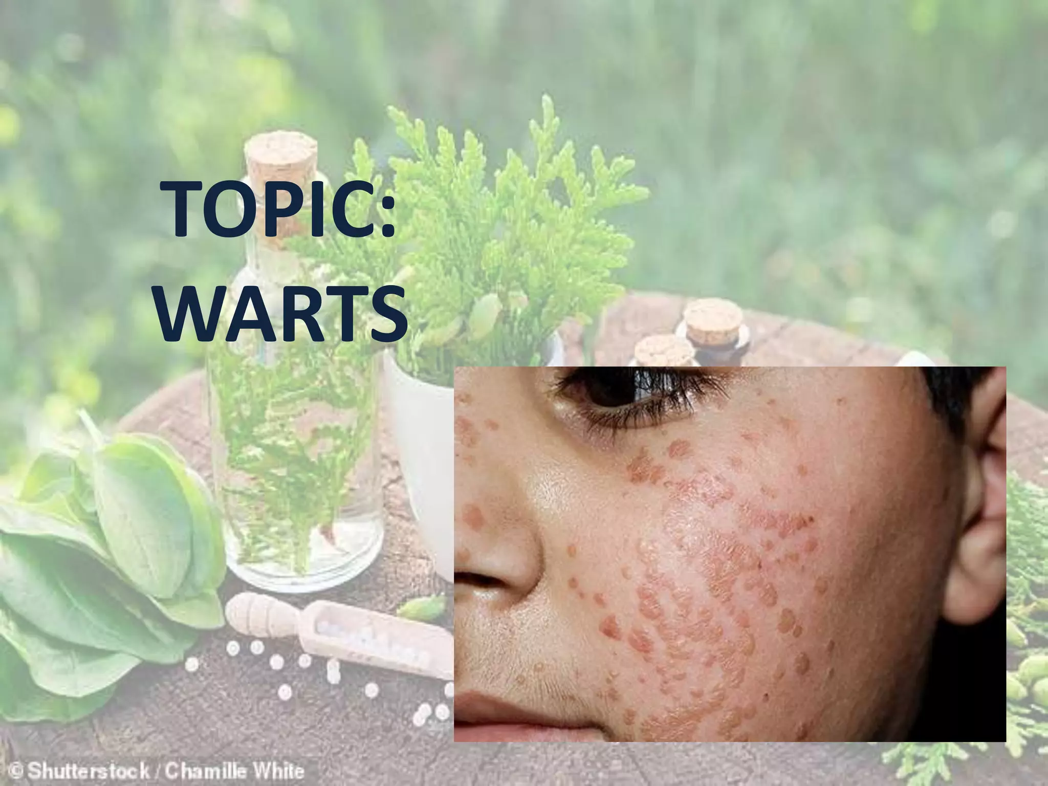 Warts | PDF | Skin and Dermatology | Diseases and Conditions