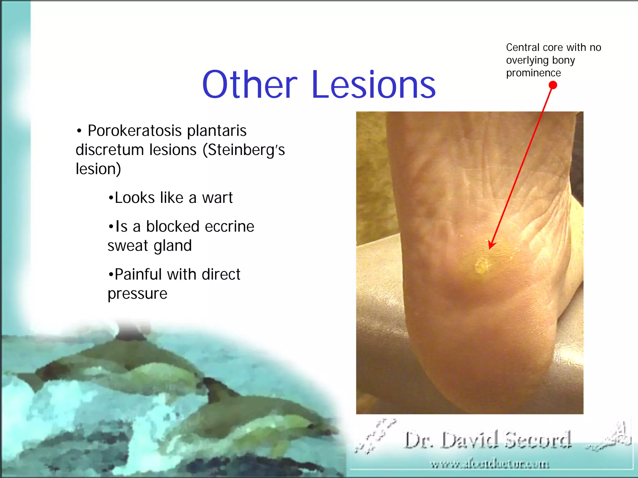 Warts And Lesions | PDF