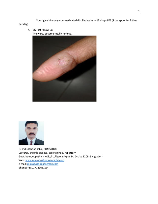 Warts | PDF | Skin and Dermatology | Diseases and Conditions