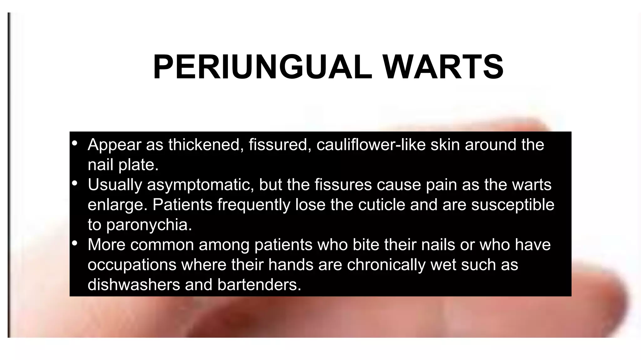 WARTS | PPTX