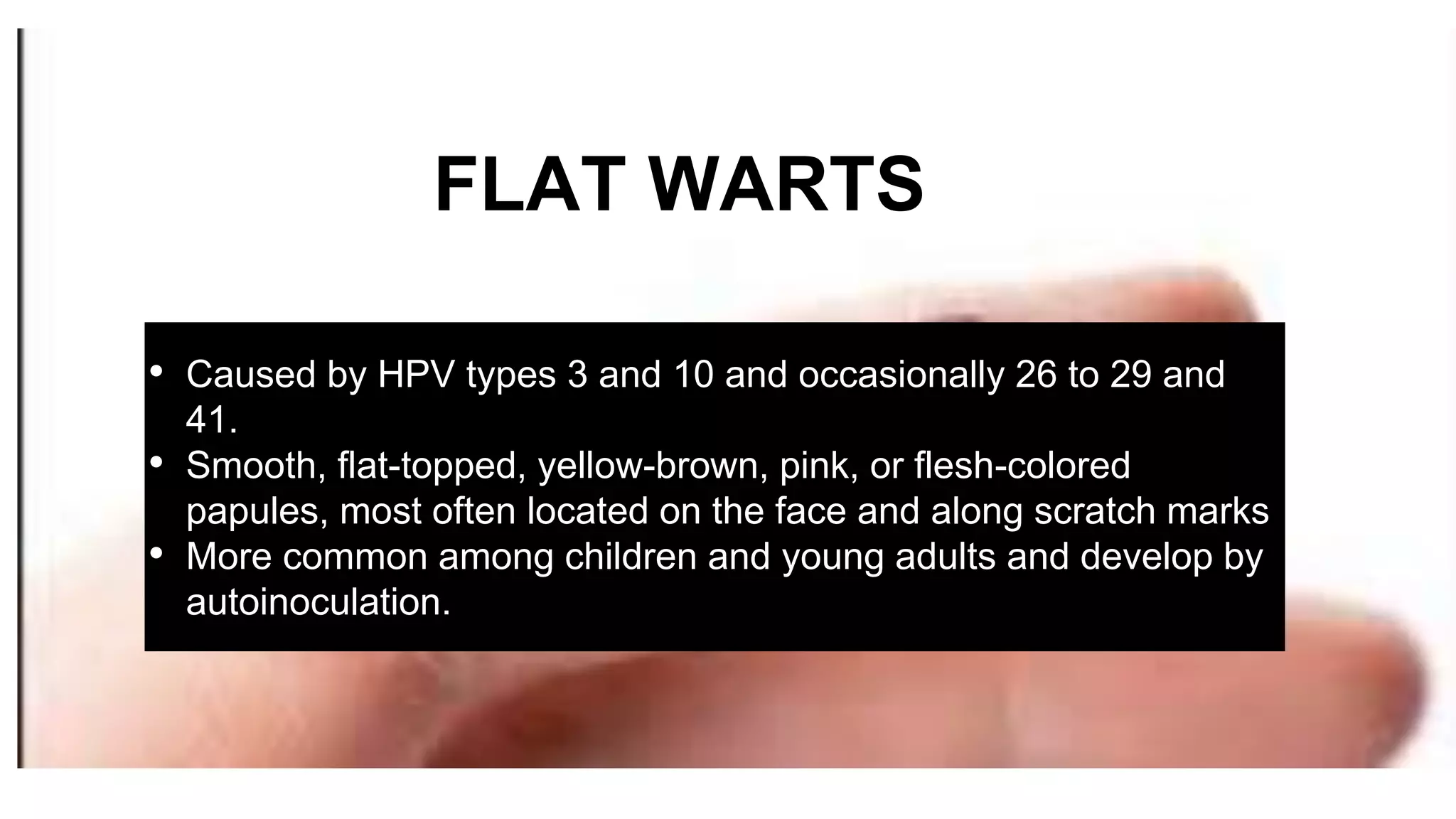 WARTS | PPTX