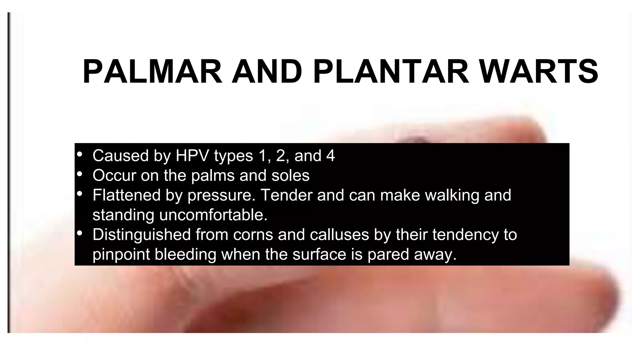 WARTS | PPTX