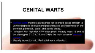 WARTS | PPTX