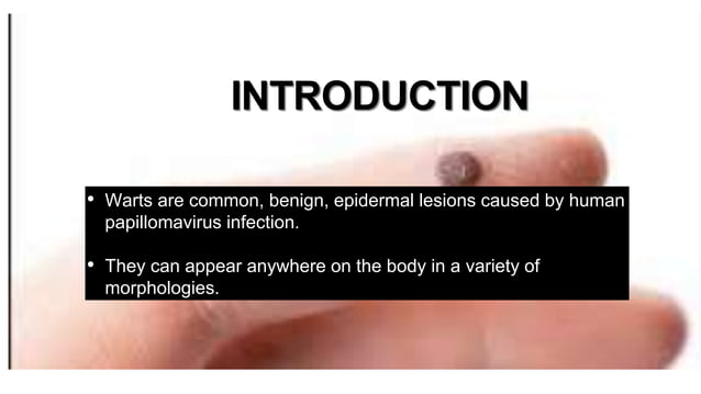 WARTS | PPTX | Skin and Dermatology | Diseases and Conditions