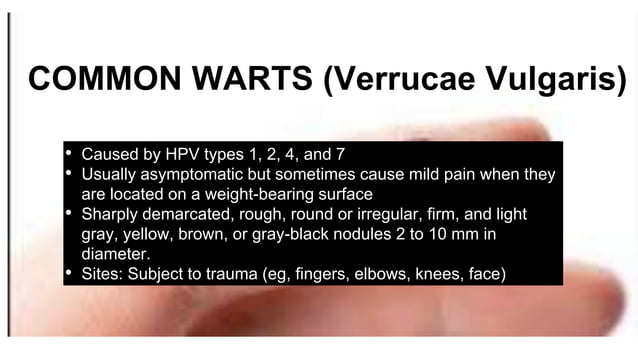 WARTS | PPTX | Skin and Dermatology | Diseases and Conditions