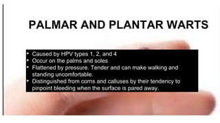 WARTS | PPTX