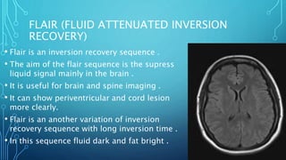 FLAIR,STIR,FLASH,PDW Sequences presented by waseem javid | PPTX