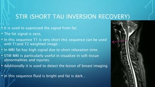 FLAIR,STIR,FLASH,PDW Sequences presented by waseem javid | PPTX