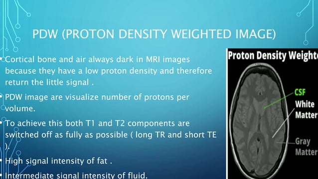 FLAIR,STIR,FLASH,PDW Sequences presented by waseem javid | PPTX ...