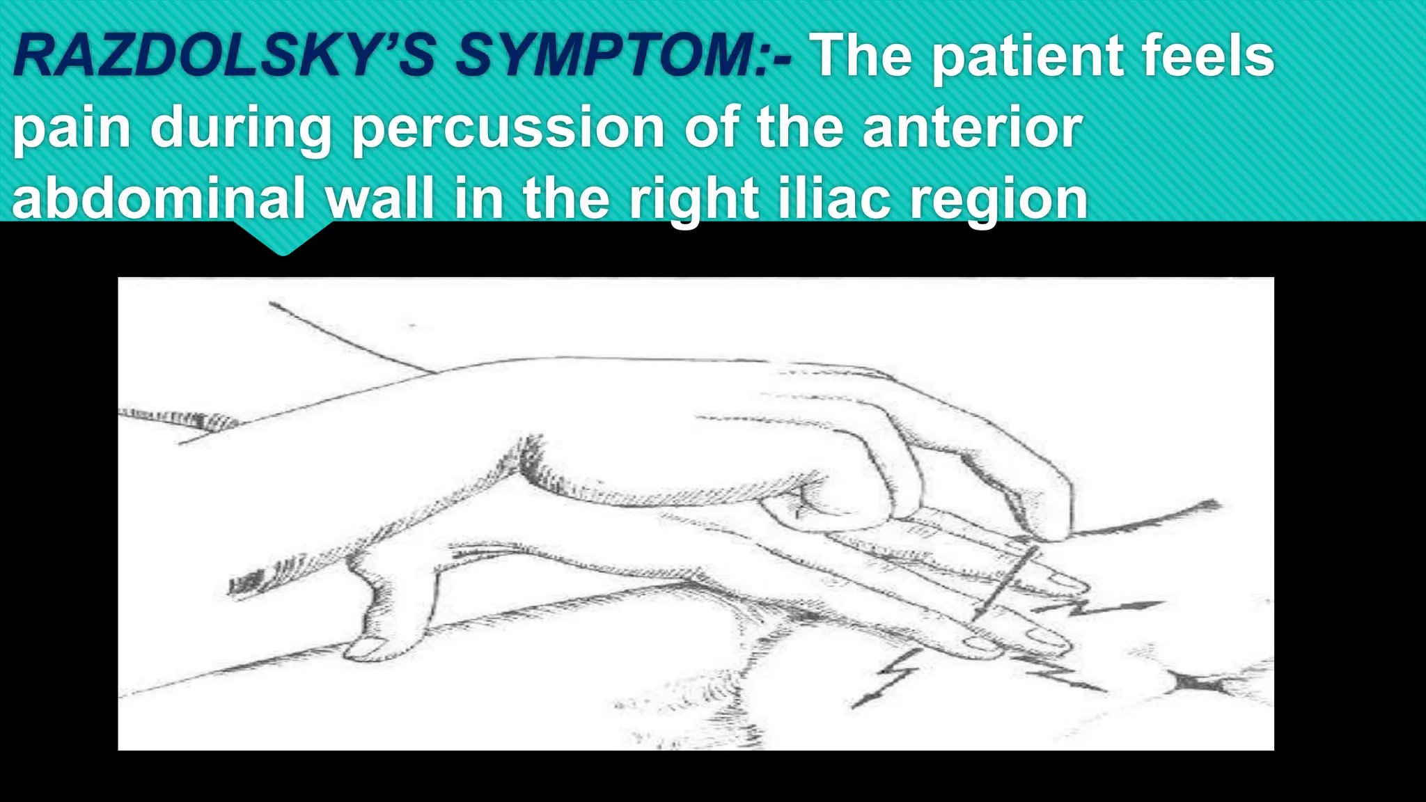 Wasim,Shreeja Symptomatology of acute surgery disease of the abdominal ...