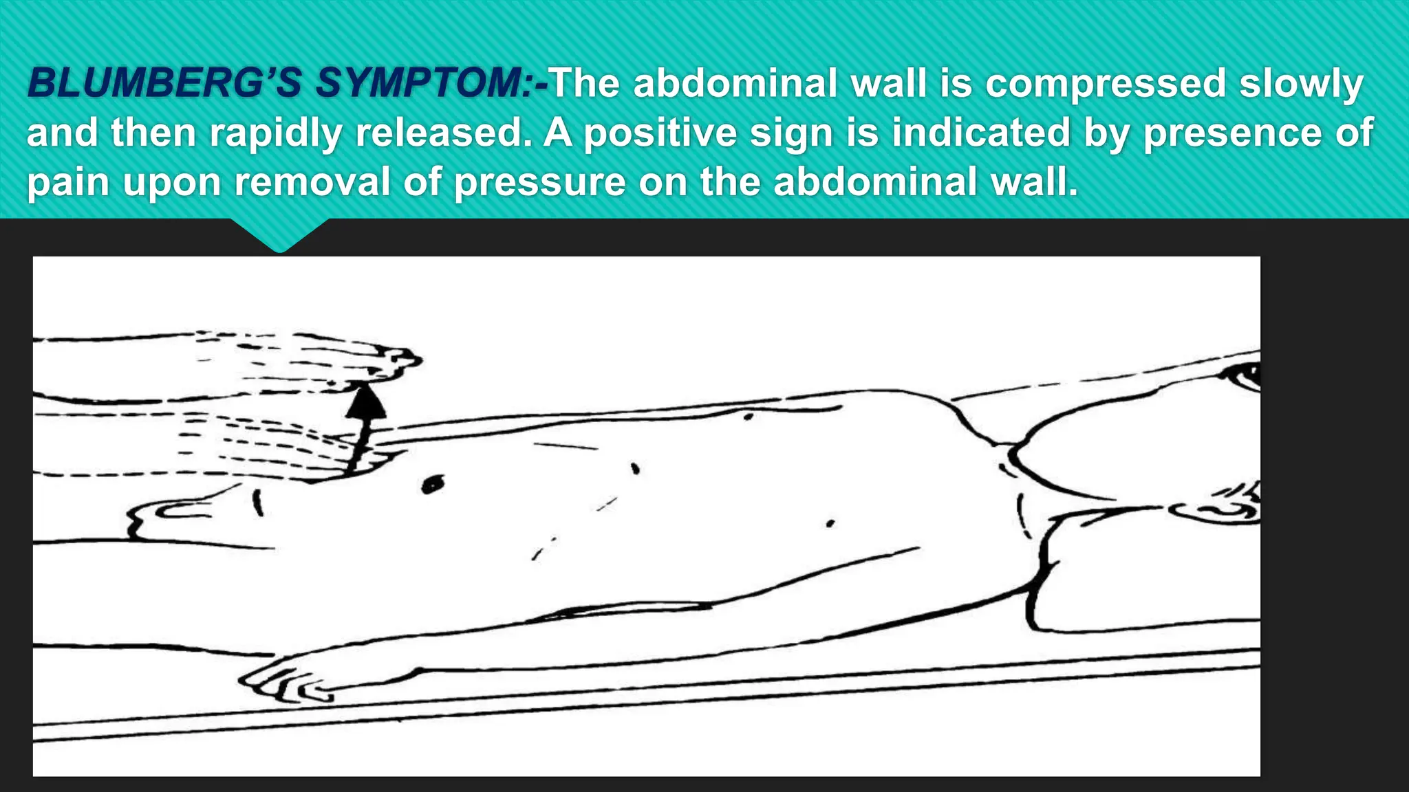 Wasim,Shreeja Symptomatology of acute surgery disease of the abdominal ...