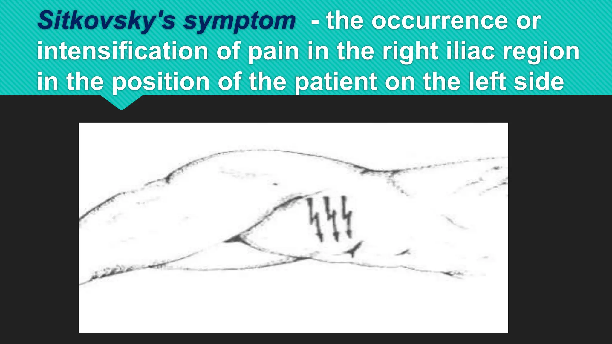 Wasim,Shreeja Symptomatology of acute surgery disease of the abdominal ...
