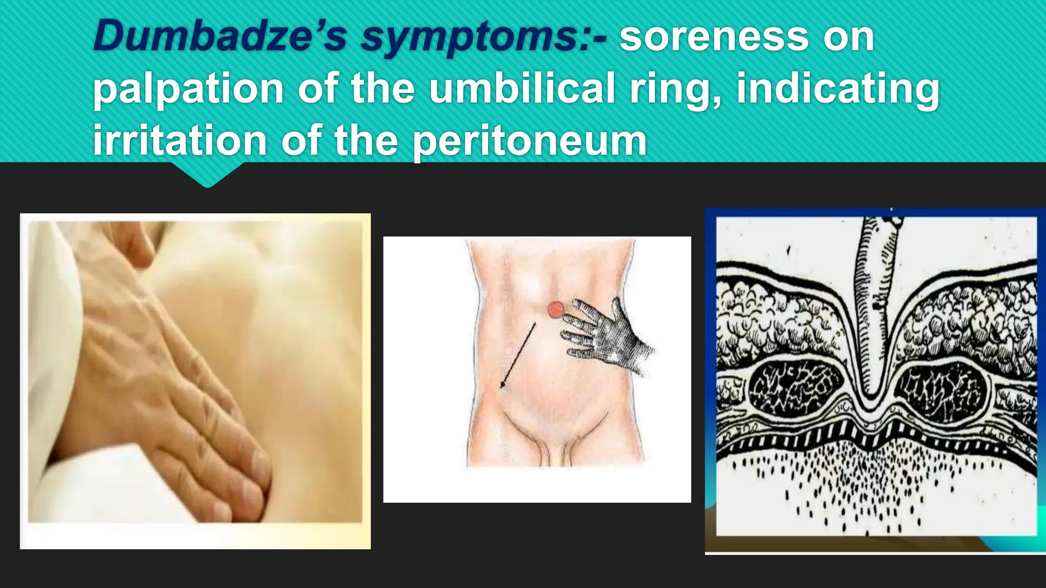 Wasim,Shreeja Symptomatology of acute surgery disease of the abdominal ...