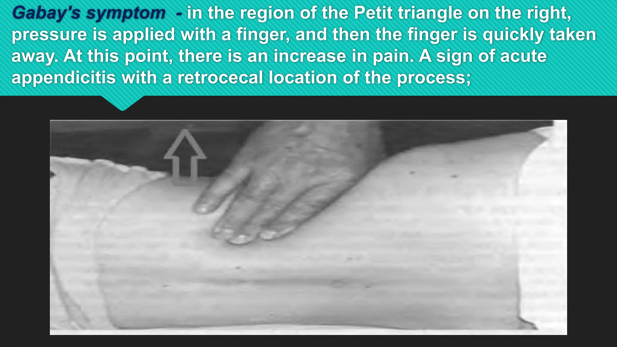 Wasim,Shreeja Symptomatology of acute surgery disease of the abdominal ...