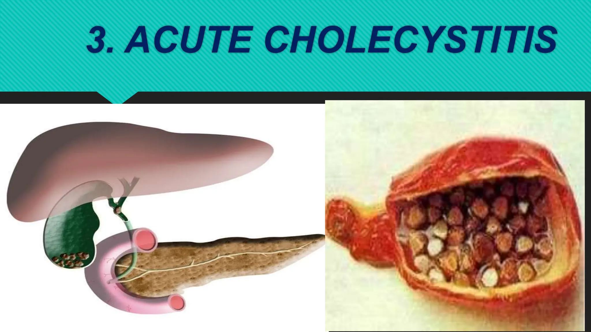 Wasim,Shreeja Symptomatology of acute surgery disease of the abdominal ...