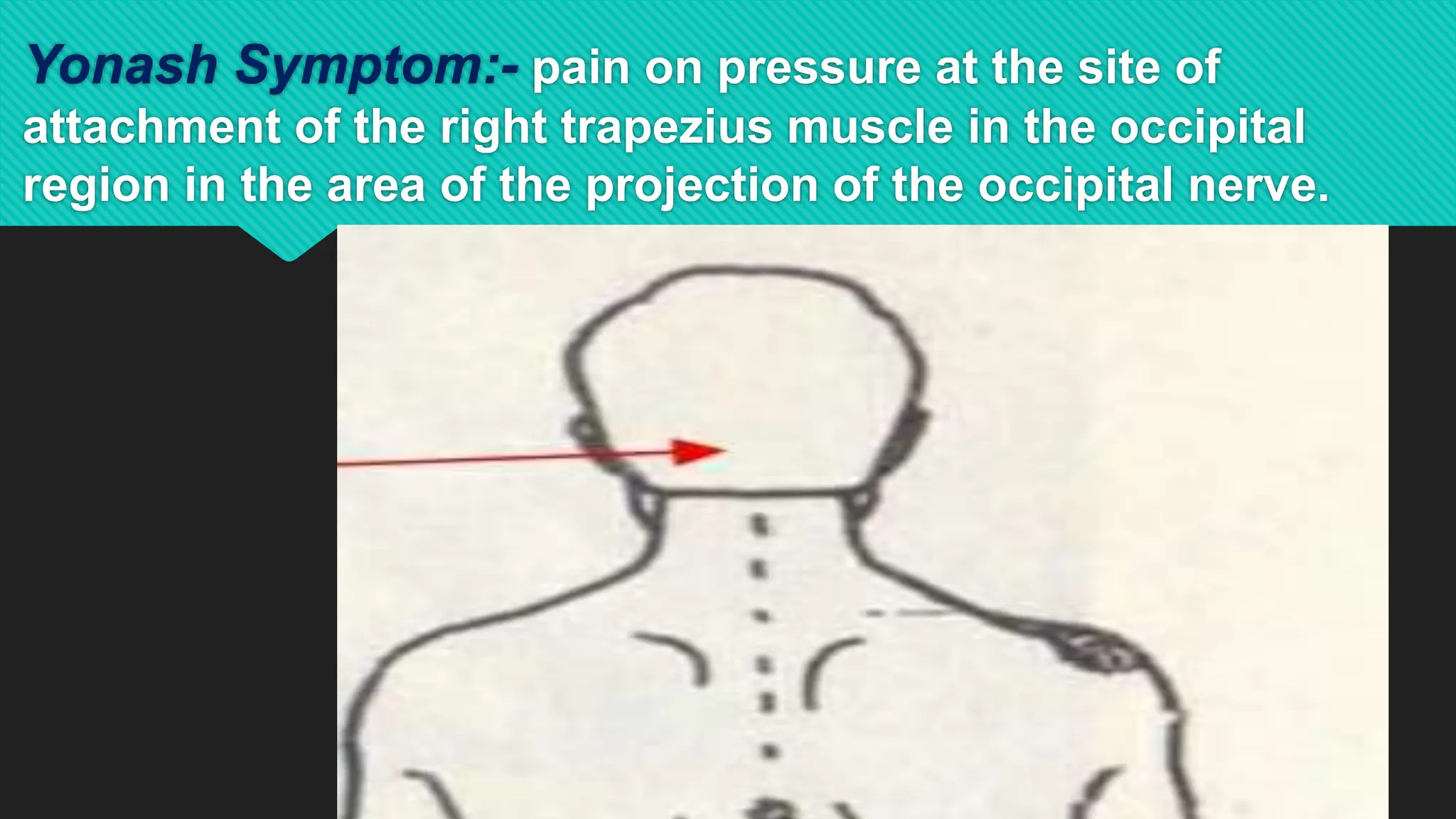 Wasim,Shreeja Symptomatology of acute surgery disease of the abdominal ...