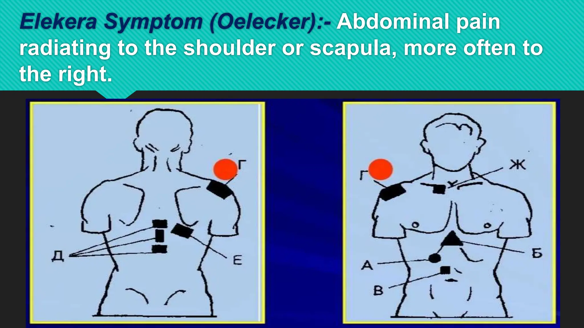 Wasim,Shreeja Symptomatology of acute surgery disease of the abdominal ...