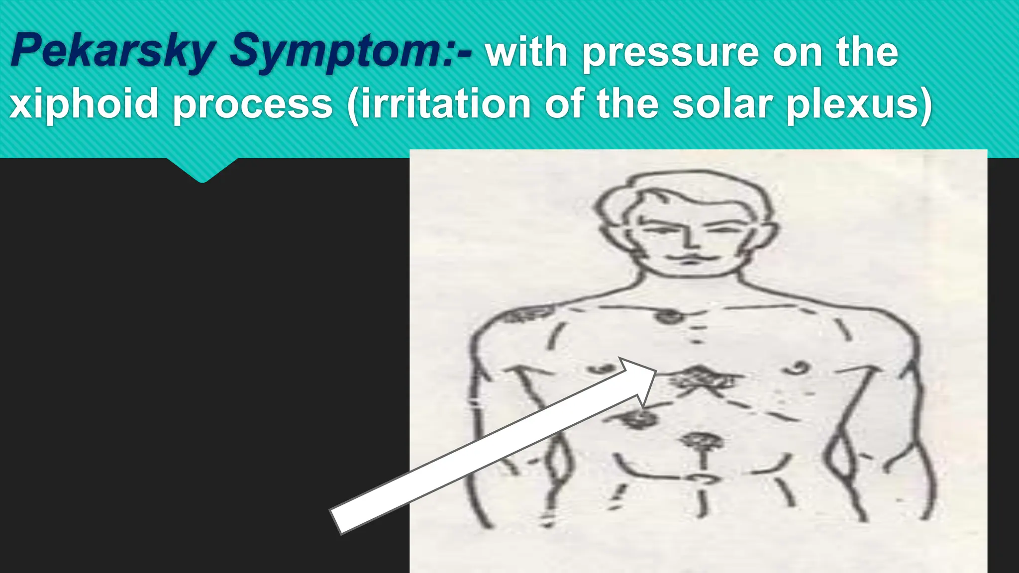 Wasim,Shreeja Symptomatology of acute surgery disease of the abdominal ...