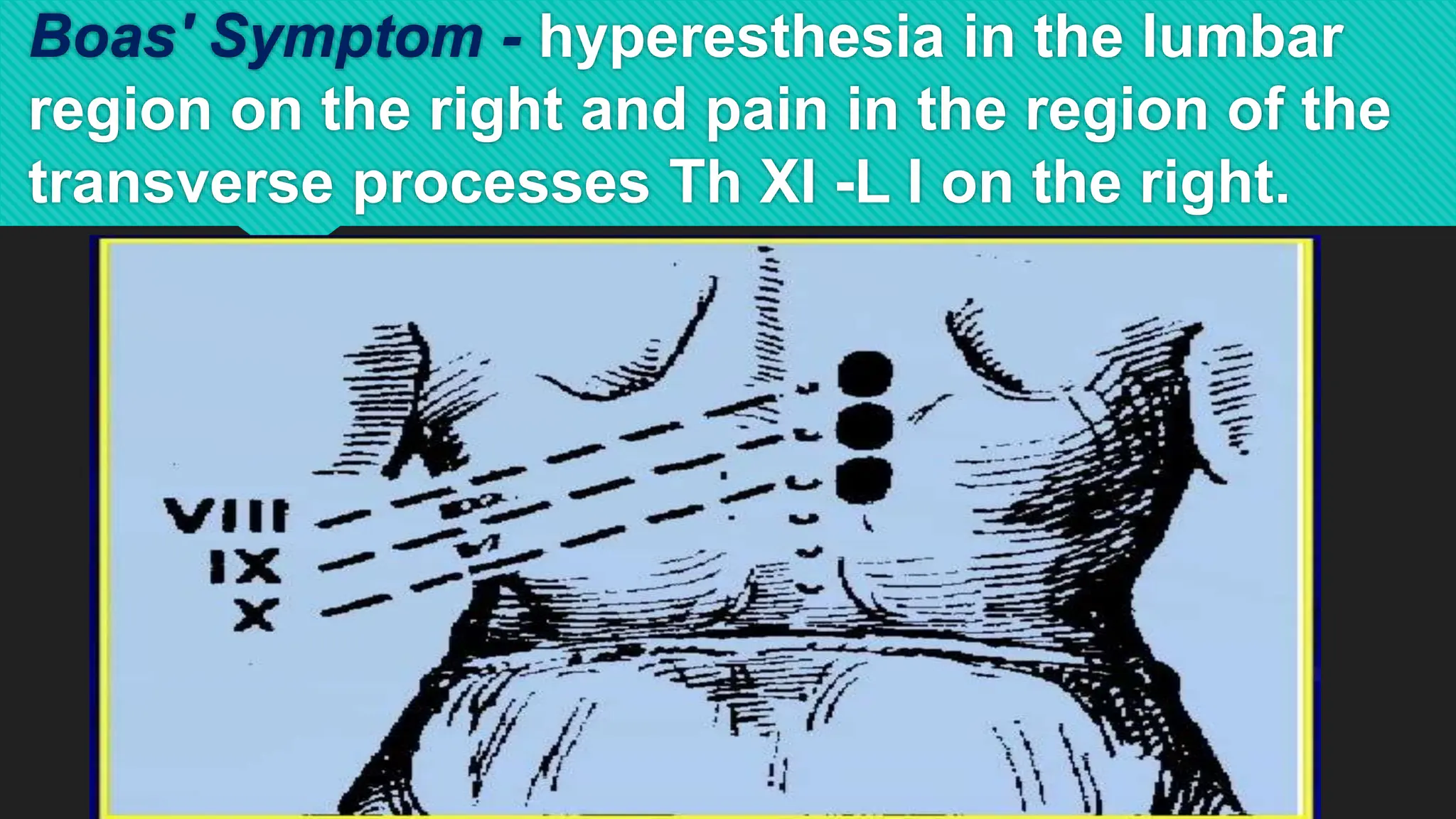 Wasim,Shreeja Symptomatology of acute surgery disease of the abdominal ...