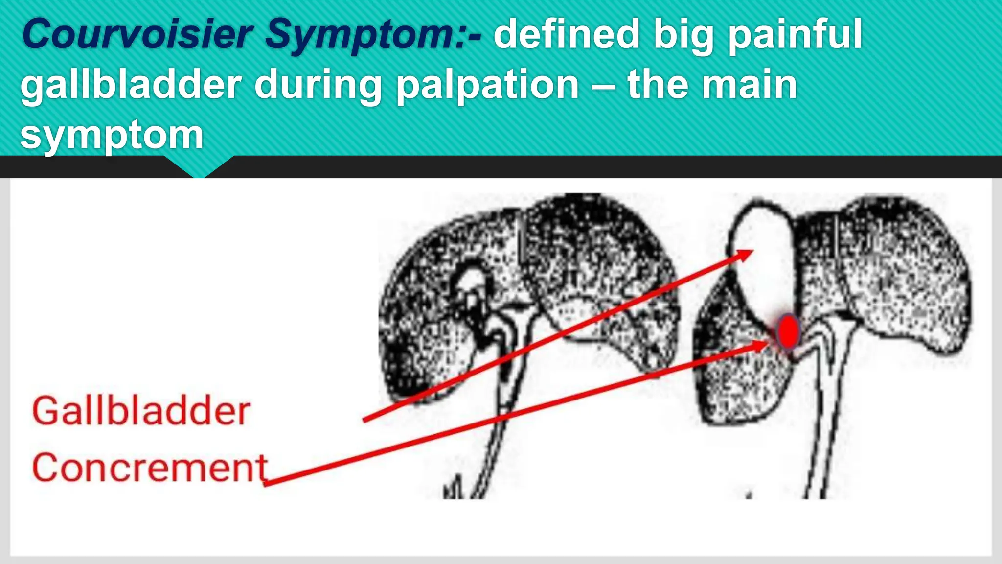 Wasim,Shreeja Symptomatology of acute surgery disease of the abdominal ...