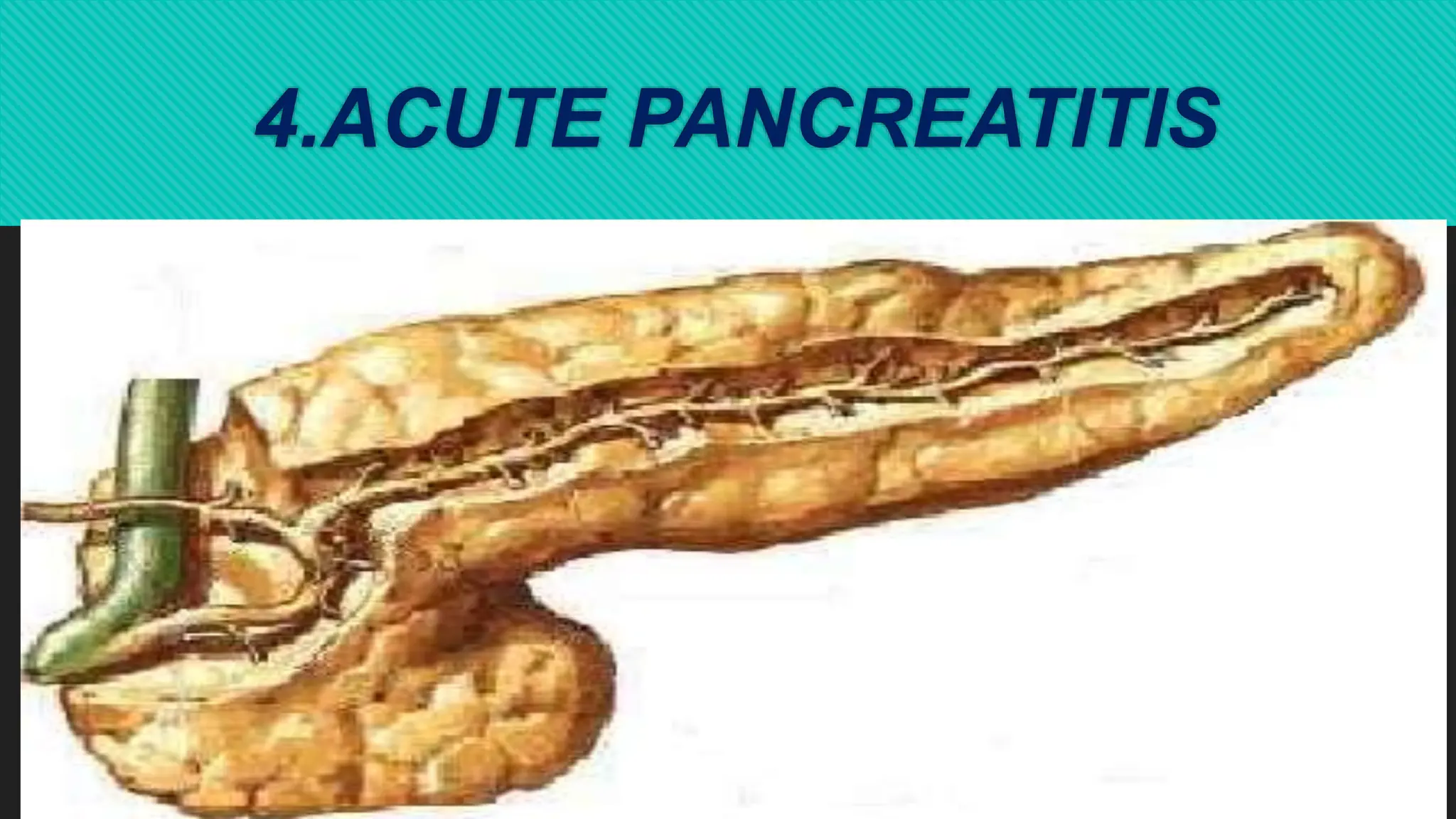 Wasim,Shreeja Symptomatology of acute surgery disease of the abdominal ...