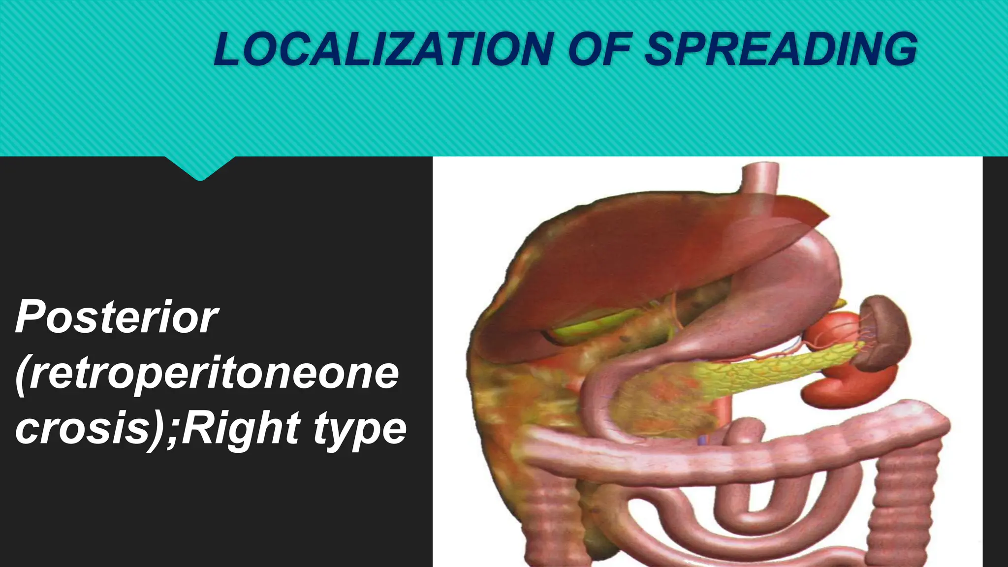 Wasim,Shreeja Symptomatology of acute surgery disease of the abdominal ...