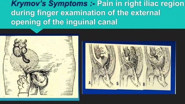 Wasim,Shreeja Symptomatology of acute surgery disease of the abdominal ...