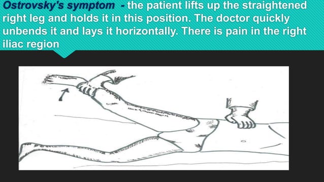 Wasim,Shreeja Symptomatology of acute surgery disease of the abdominal ...