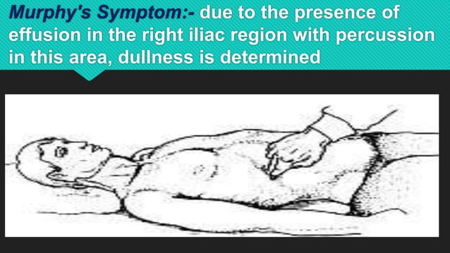 Wasim,Shreeja Symptomatology of acute surgery disease of the abdominal ...
