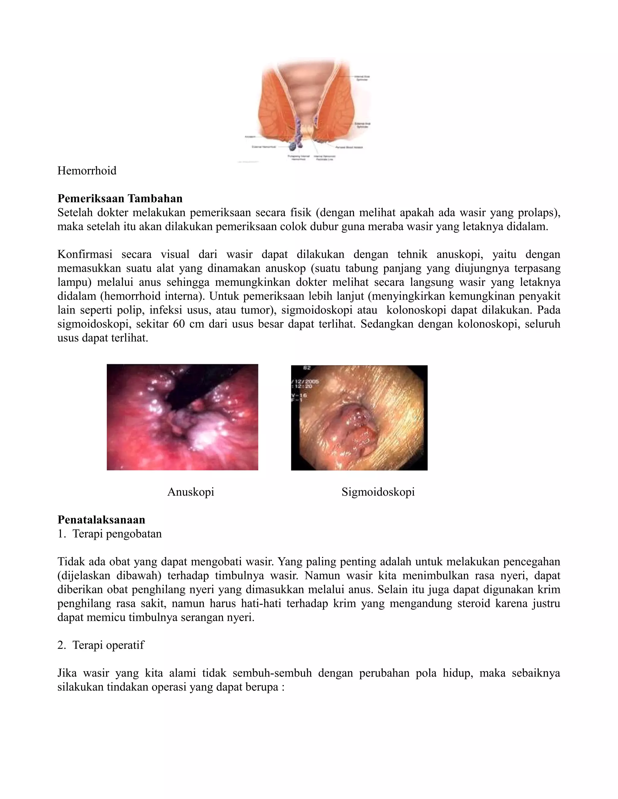 Wasir hemorrhoid | PDF