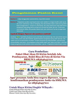 Wasir masih kecil apa perlu di operasi | PDF