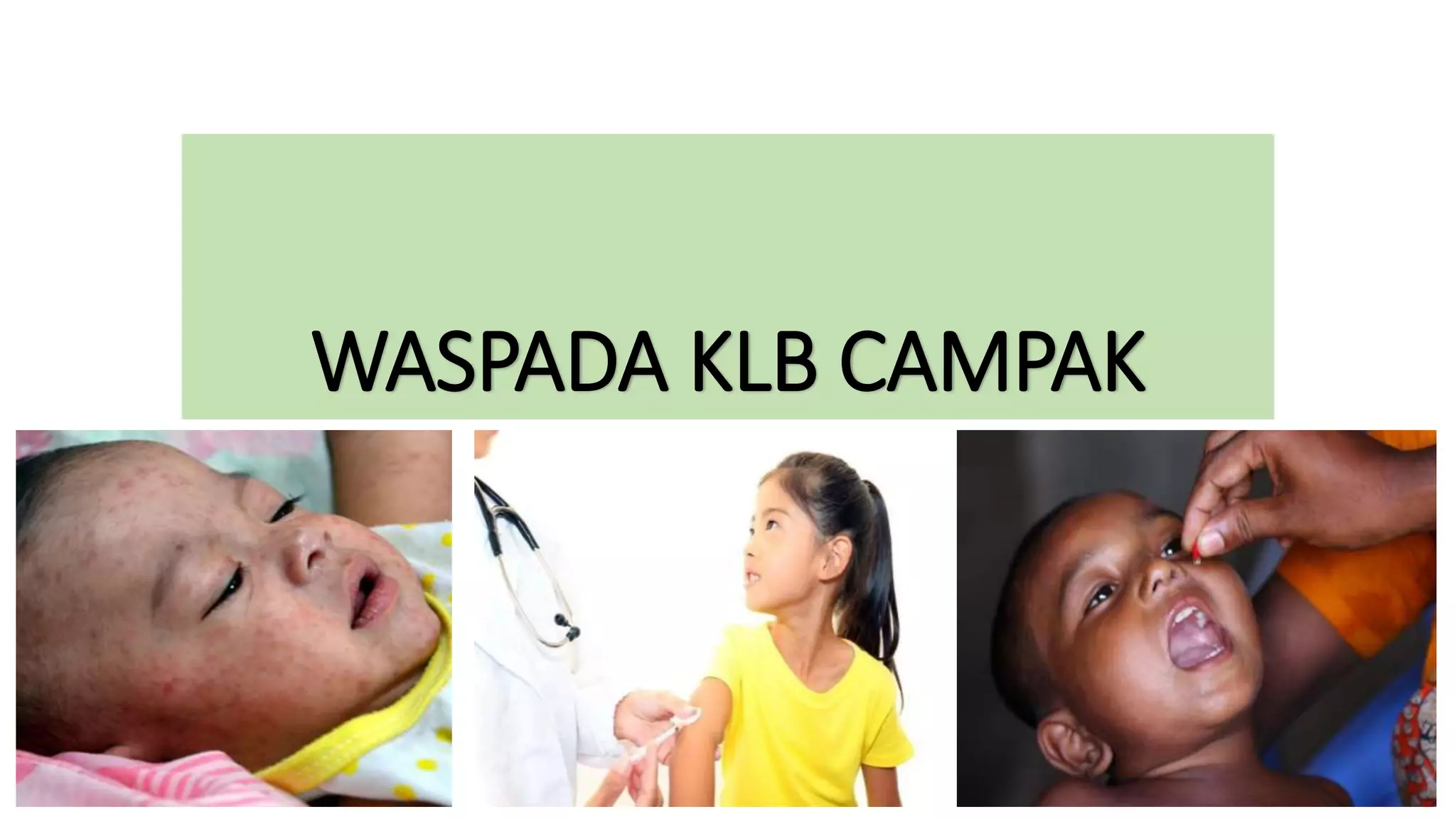 Waspada Campak.pptx