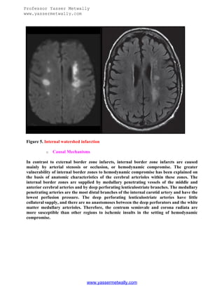Issues in radiological pathology: Radiological pathology of watershed ...