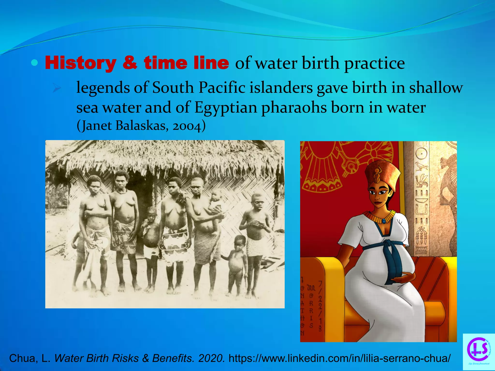 Water birth. Risk & Benefits | PDF