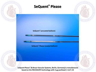Eluting balloons, the mechanism of action, indications for use Ivan. G ...