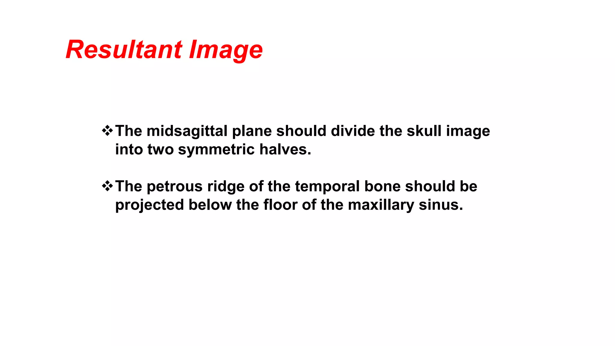 Waters projection | PPTX